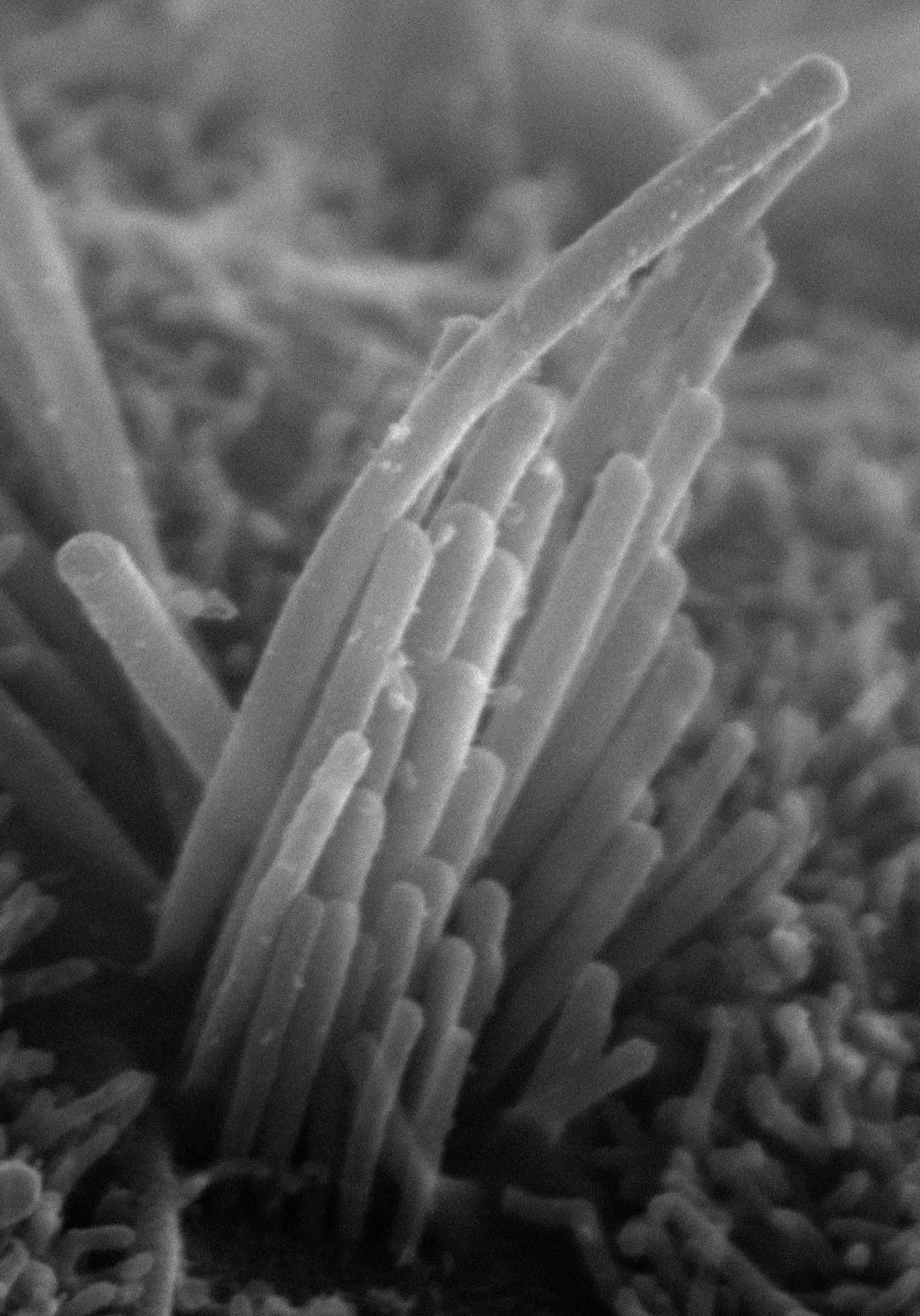 Hear ye! Drug prompts inner ear stem cells to regenerate | The Stem Cellar