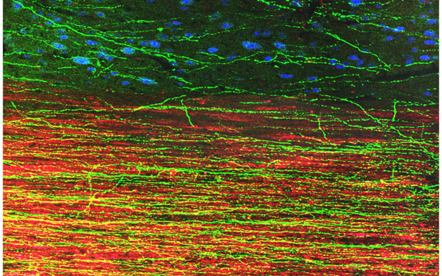 Grafted Stem Cells Snake through Spinal Cord, CIRM-Funded Study Finds ...