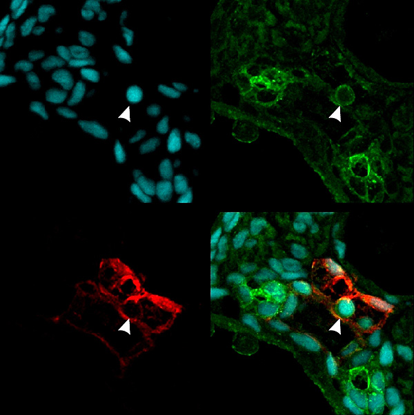 CIRM Scientists Discover Key to Blood Cells’ Building Blocks | The Stem ...