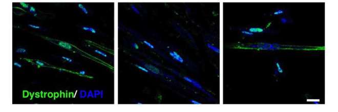 Stem cell stories that caught our eye: A groove for healing hearts ...