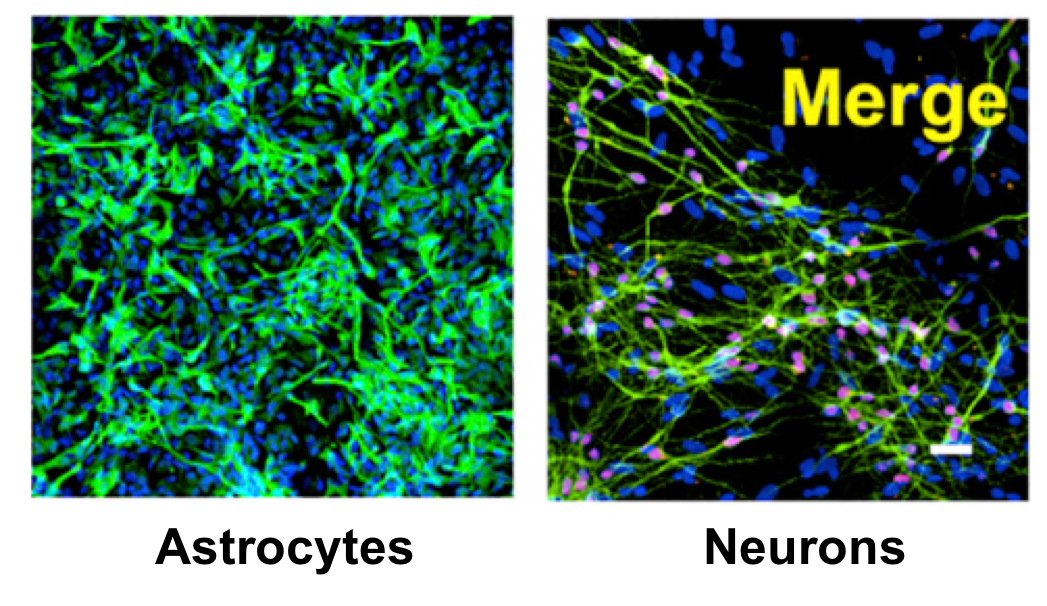 Skipping a Step: Turning Brain Cells Directly into Neurons | The Stem ...