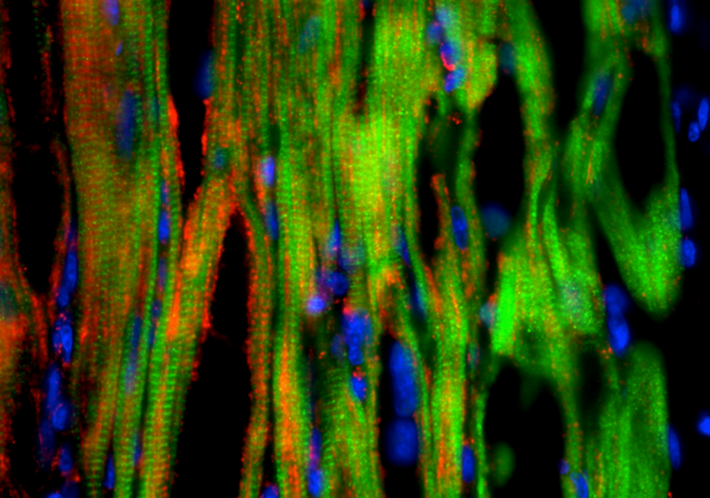 Regenerating damaged muscle after a heart attack | The Stem Cellar