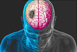 New approach could help turn back the clock and reverse damage for ...
