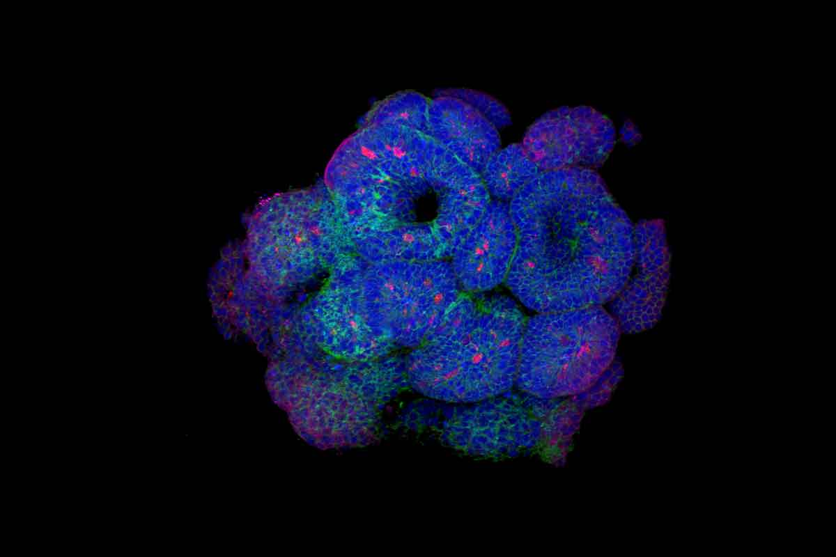 Mini-guts made from stem cells uncover mechanisms of viral infection in ...