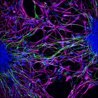 One scientist’s quest to understand autism using stem cells | The Stem ...