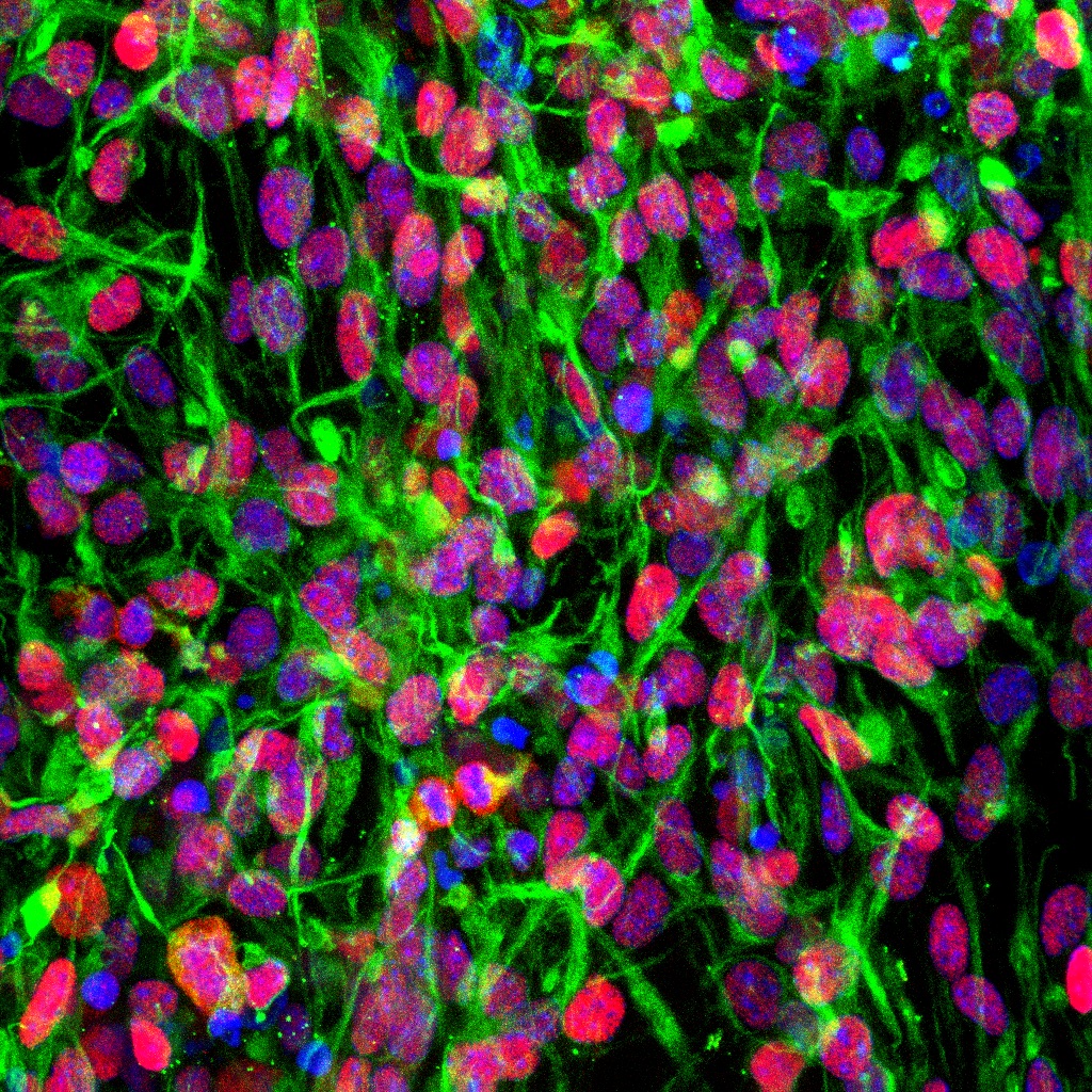 Stanford scientists are growing brain stem cells in bulk using 3D ...