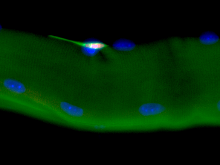 Stem Cell Stories that Caught Our Eye: GPS for Skin & Different ...