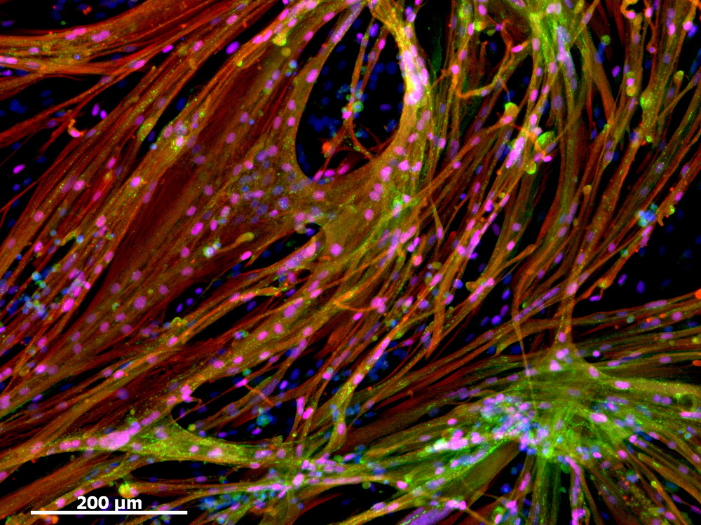 UCLA scientists on track to develop a stem cell replacement therapy for ...