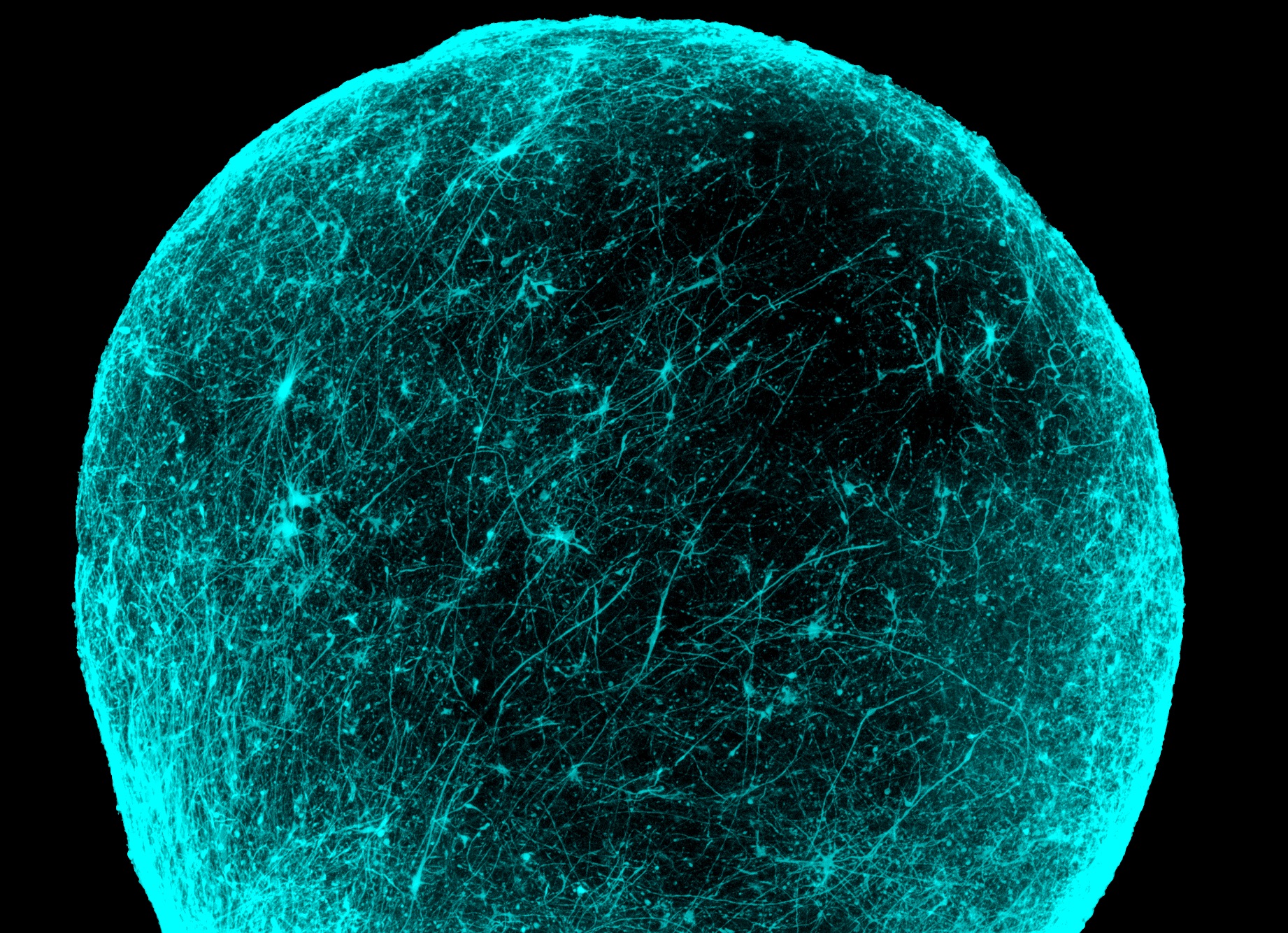 Modeling the Human Brain in 3D | The Stem Cellar