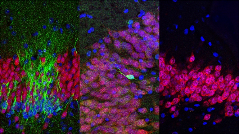 Stem Cell Roundup: No nerve cells for you, old man; stem cells take out ...