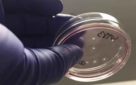 “Brains” in a dish that can create electrical impulses | The Stem Cellar
