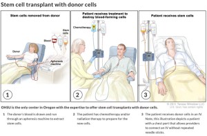 Overcoming obstacles in blood stem cell therapies | The Stem Cellar